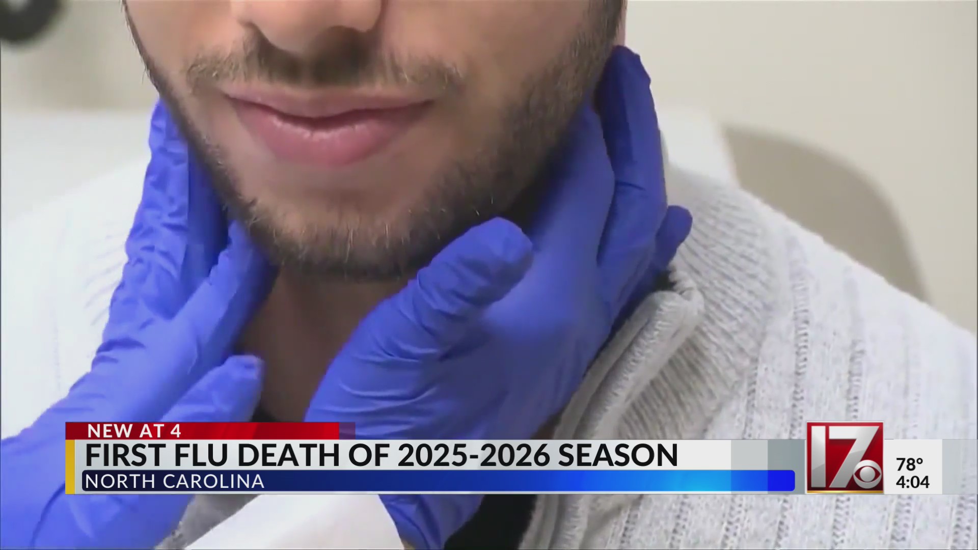 NC records first flu death of 2025-26 season – CBS17.com