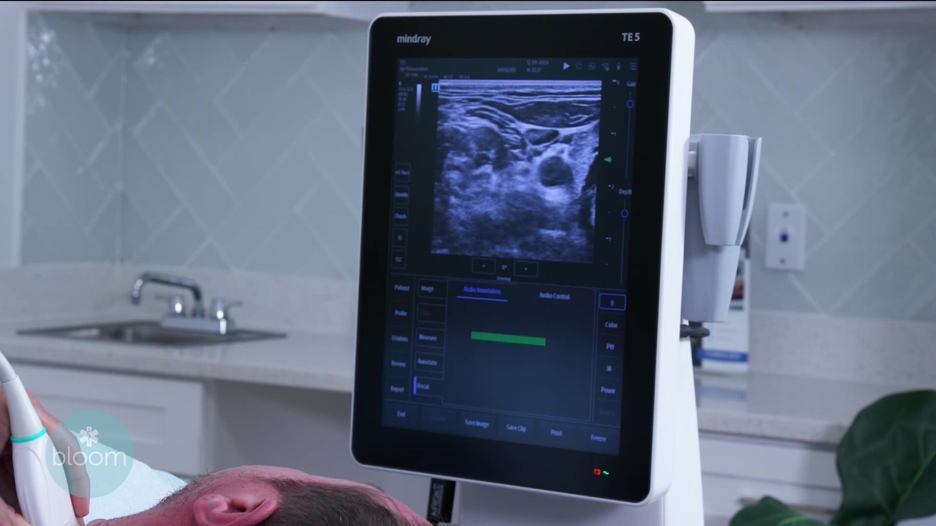 Innovative therapy designed to combat burnout syndrome | Bloom – WFLA