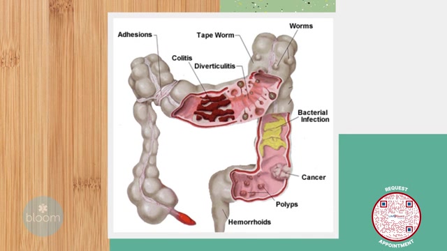 Virtual vs. traditional colonoscopies | Bloom – WFLA