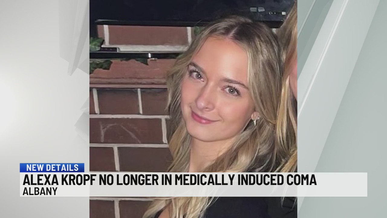 Alexa Kropf no longer in medically induced coma – NEWS10 ABC