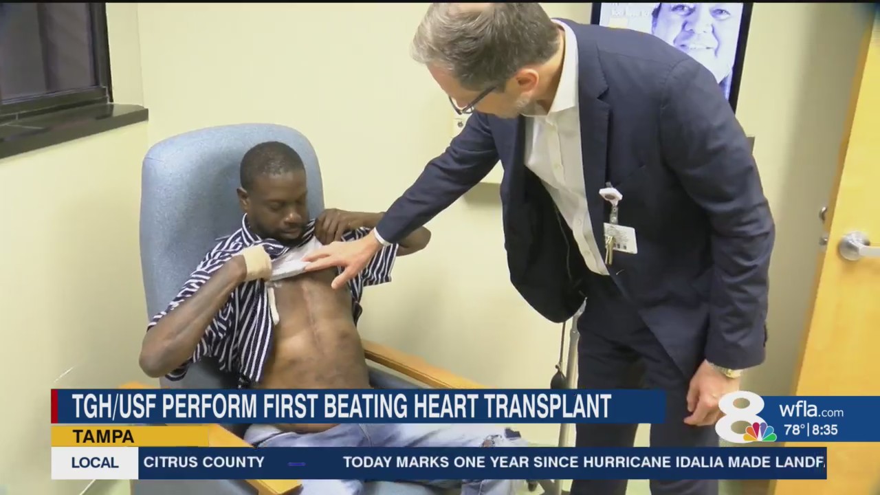 Tampa General Hospital performs beating heart transplant – WFLA