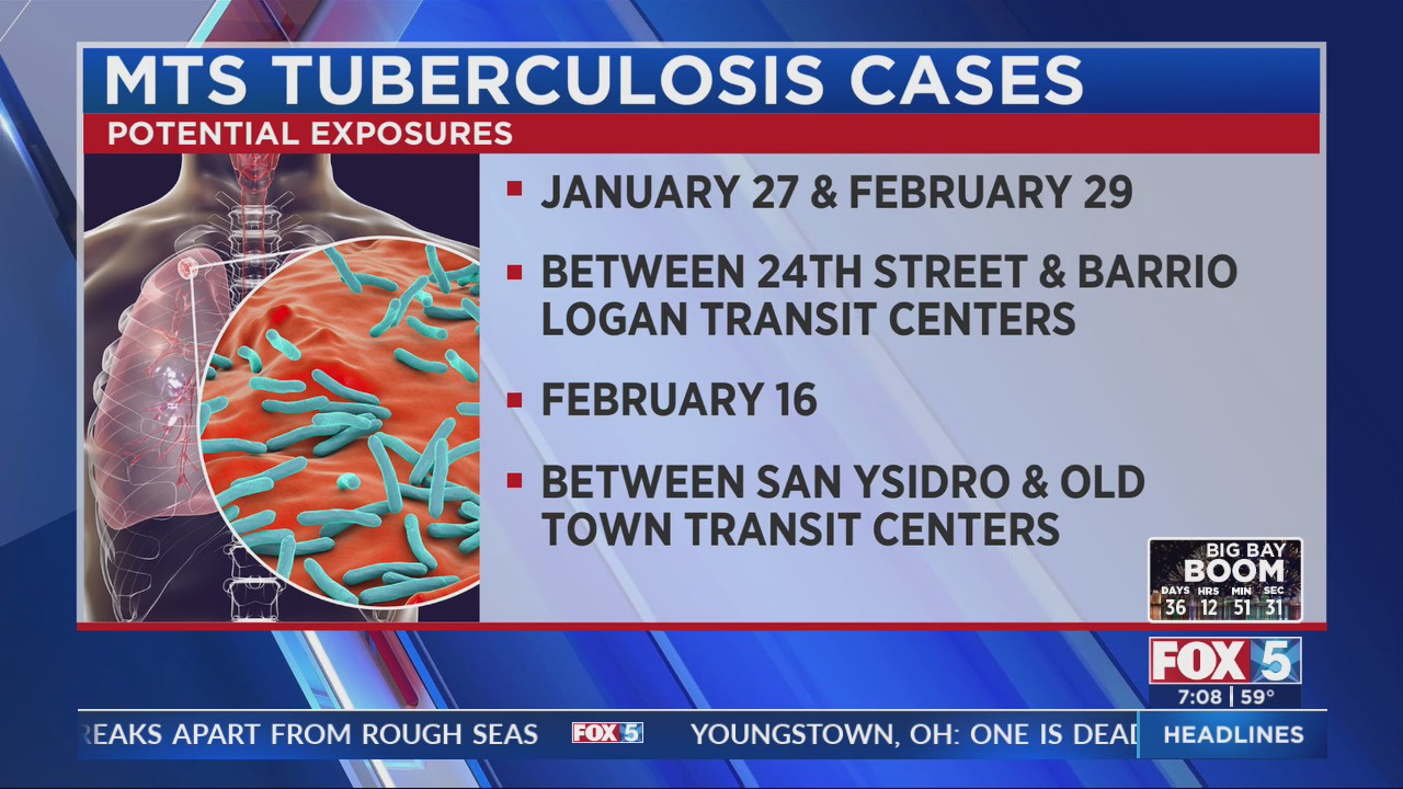 Tuberculosis exposure reported on MTS Trolley Blue Line – FOX 5 San Diego & KUSI News