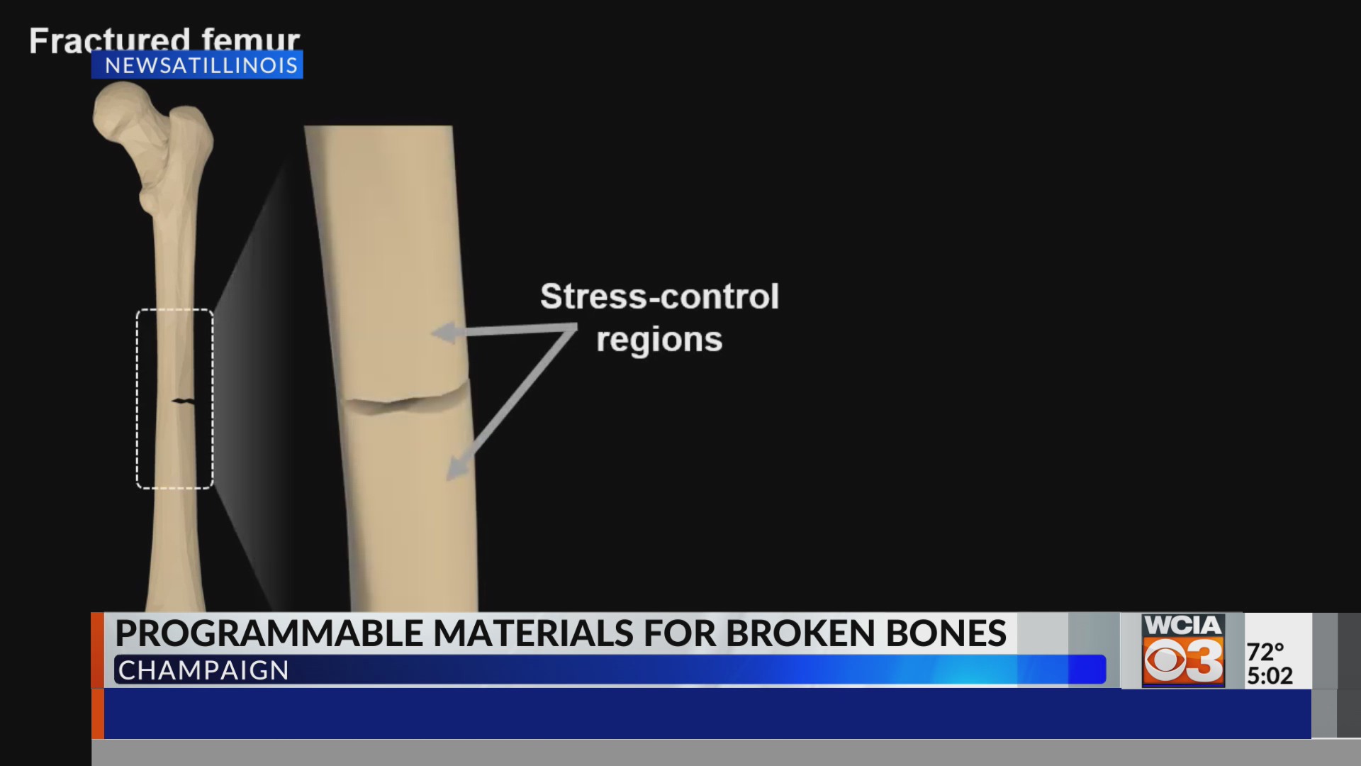 UI engineers make special material to help heal broken bones – WCIA.com