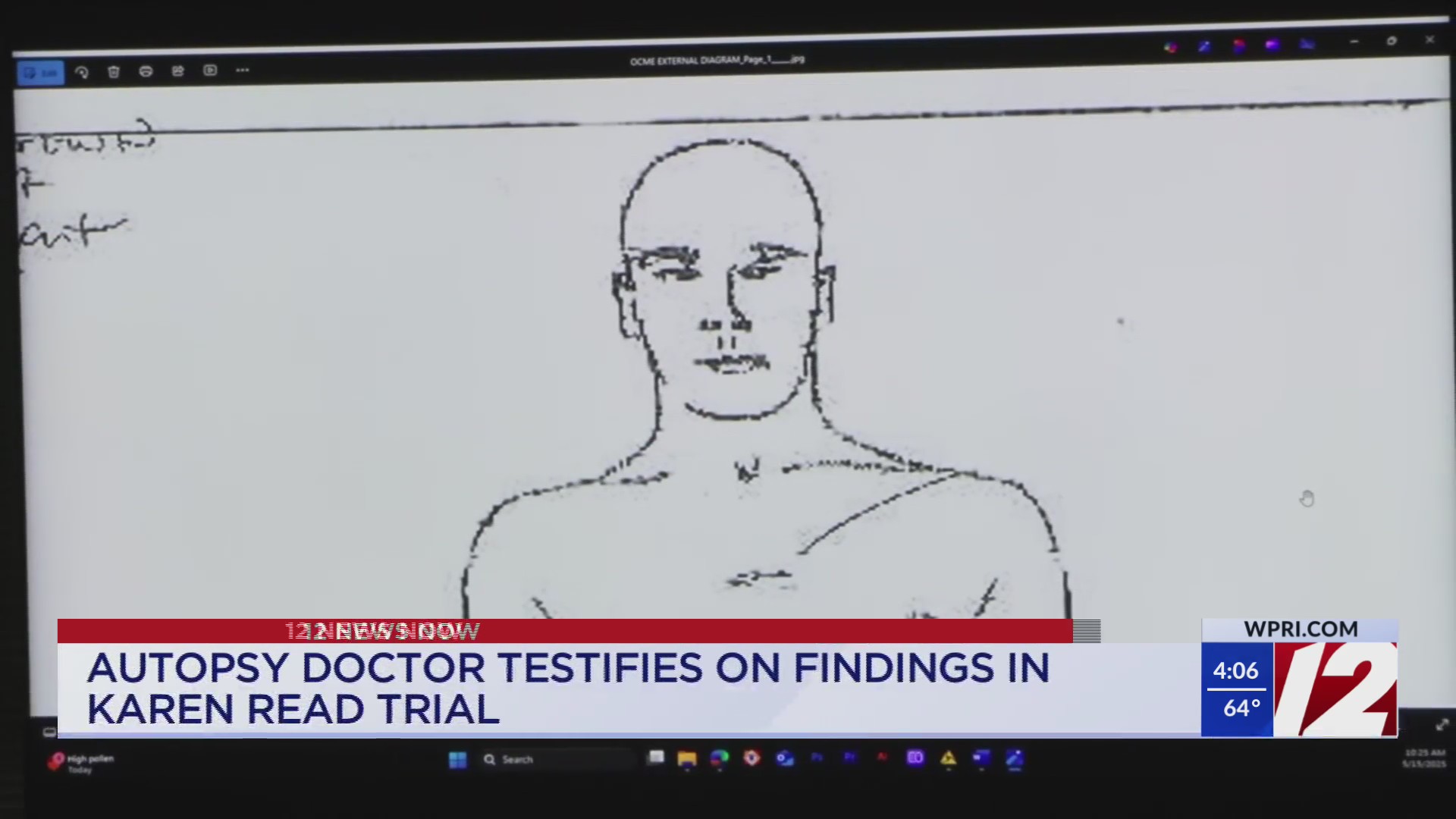 Autopsy doctor testifies on findings in Karen Read trial – WPRI.com