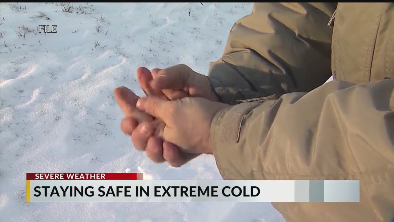 How to recognize if frostbite has started – WKBN.com