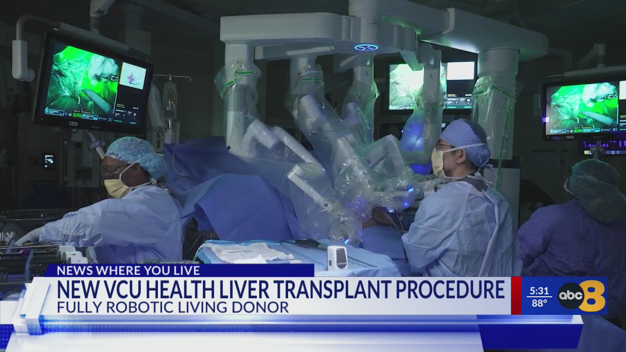 VCU Health performs nation’s first fully robotic living donor liver ...