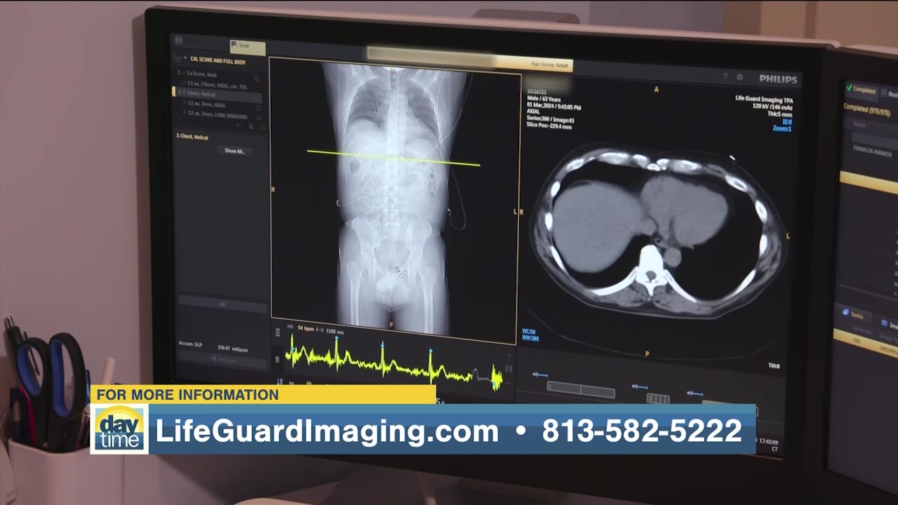 Life Guard Imaging 6-6-24 – WFLA