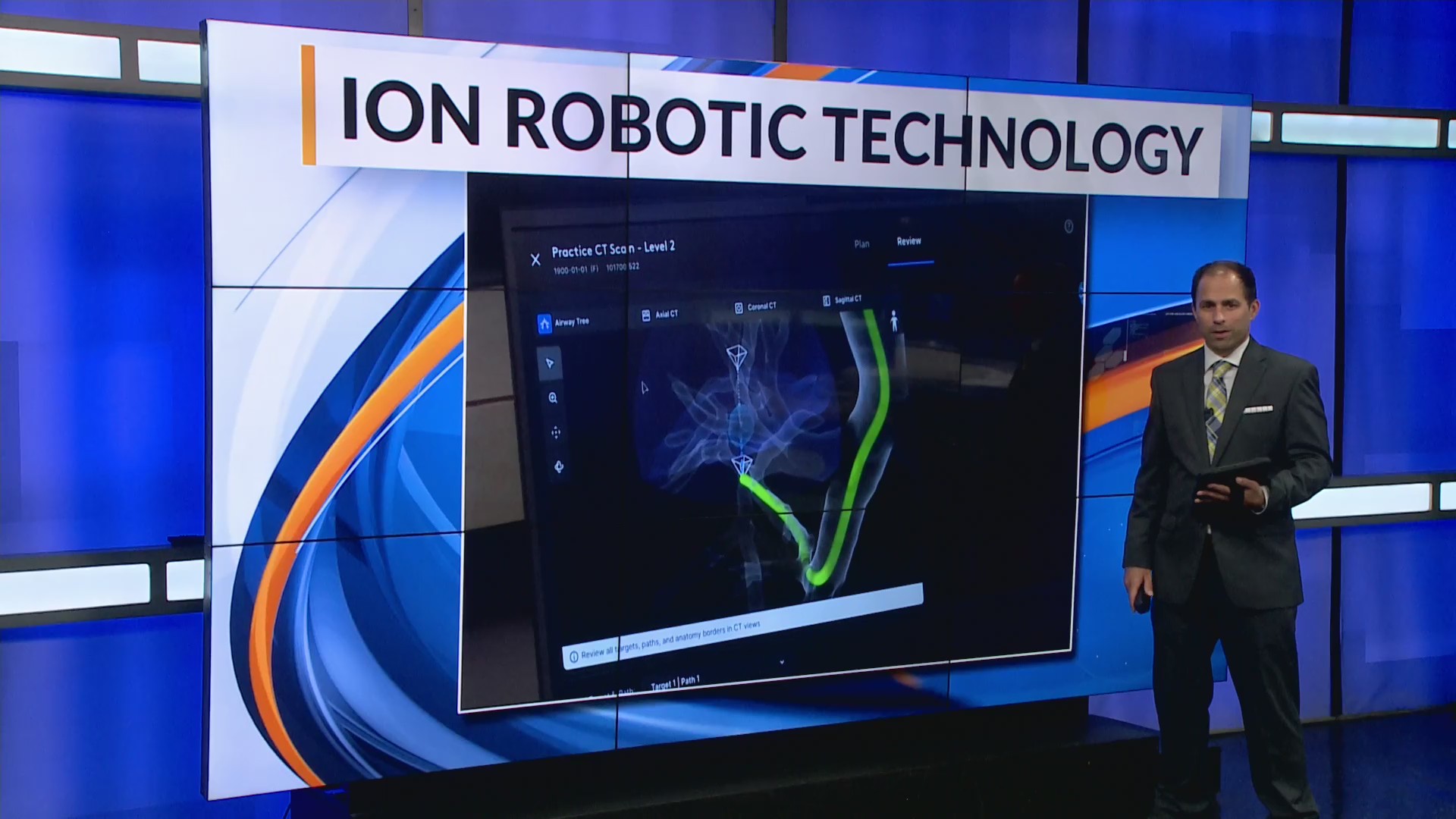 Ion Robotic Technology now offered at Bismarck Sanford – KX NEWS