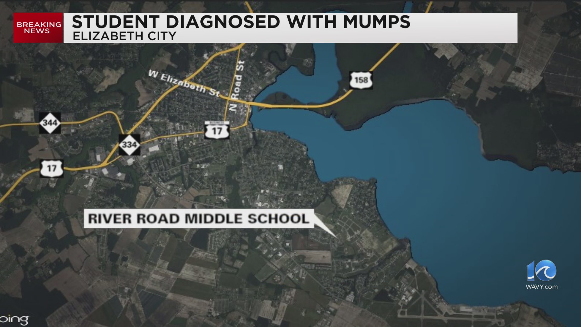 Case of mumps confirmed at Elizabeth City middle school – WAVY.com