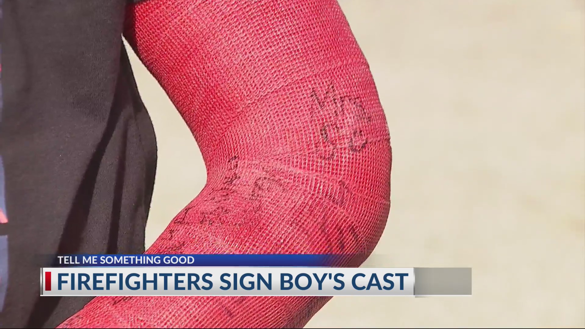 Columbus firefighters surprise boy by signing cast – NBC4 WCMH-TV