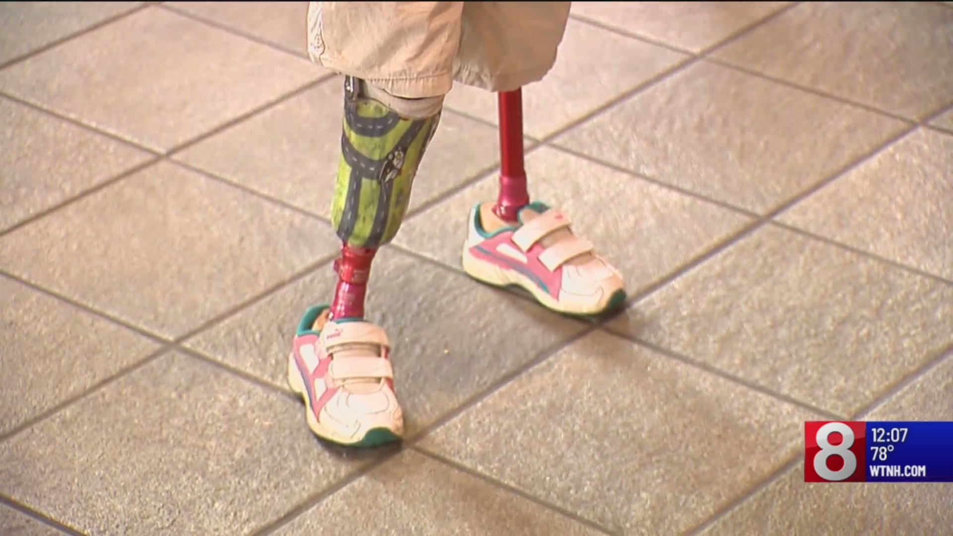 Hamden camp for children with lost limbs teaches life lessons – WTNH.com