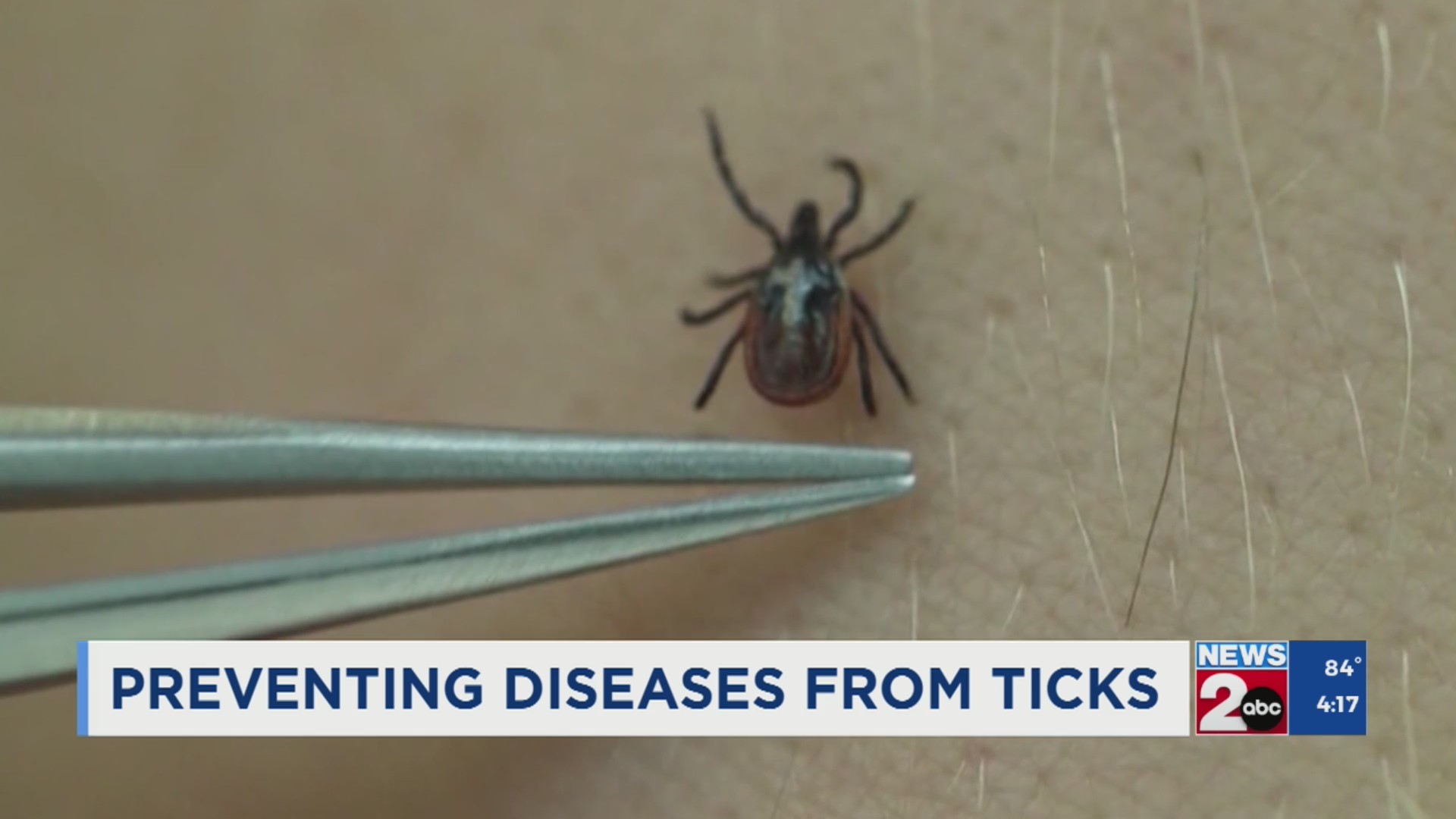 Preventing diseases from ticks – WKRN News 2