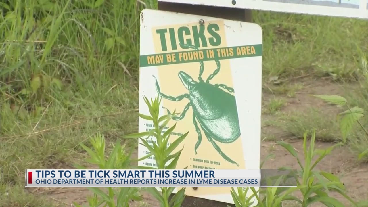 Tips to stay tick-smart this summer – NBC4 WCMH-TV