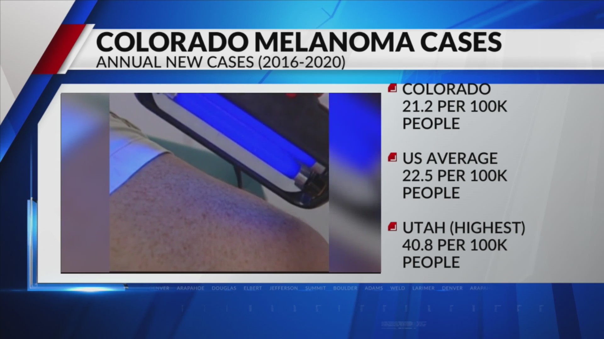 Colorado’s melanoma cases on the rise – FOX31 Denver