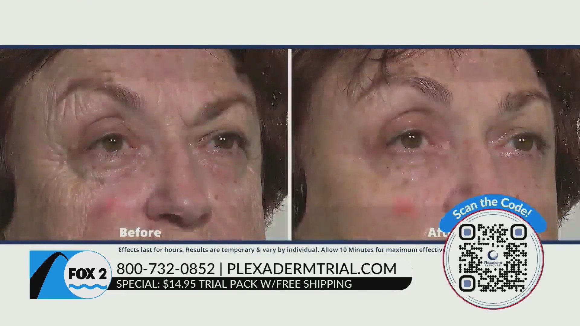 Reserve visible signs of ageing with the Plexaderm 10-minute challenge – FOX 2