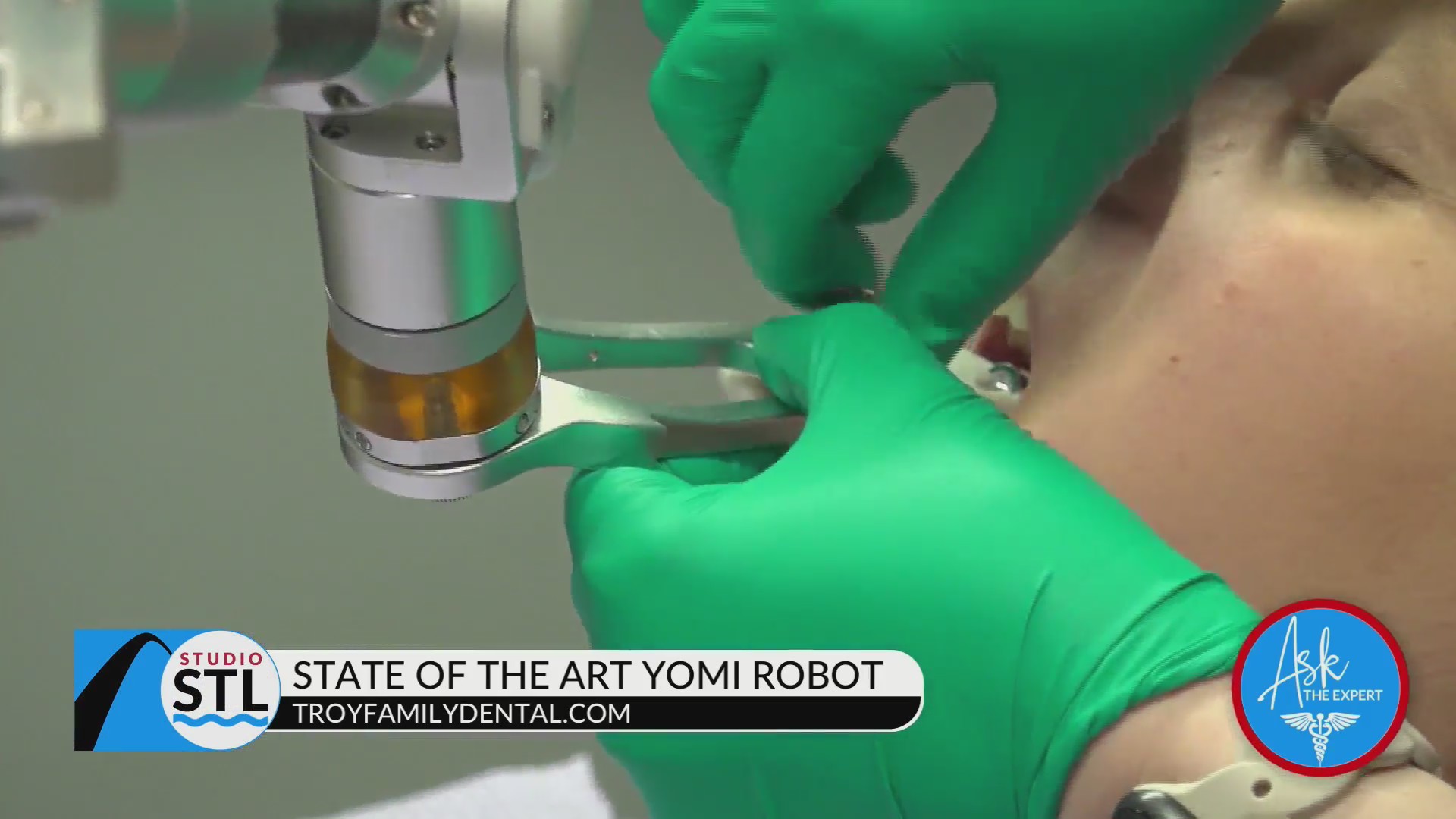 Troy Family Dental in Illinois is the only dental practice with YOMI technology in the area! – FOX 2