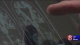 Yale doctor explains how quick hand and thumb test can determine ...