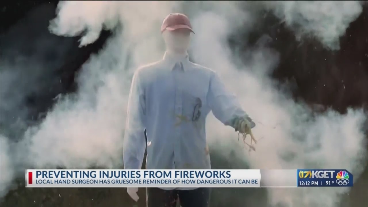 Hand surgeon shares tips on how to prevent injuries from fireworks ...
