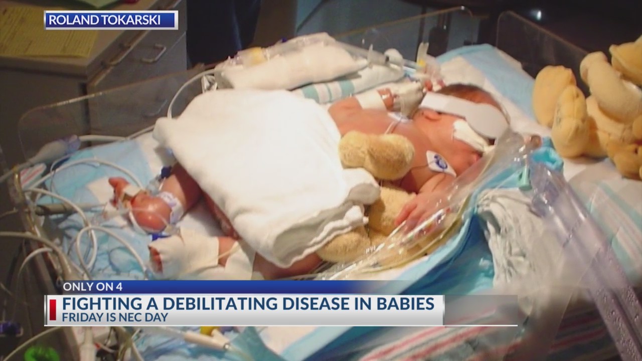 Fighting a debilitating disease in babies – NBC4 WCMH-TV