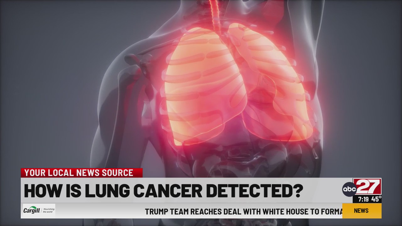 Lung cancer rates may be declining but not as officials expect – ABC27