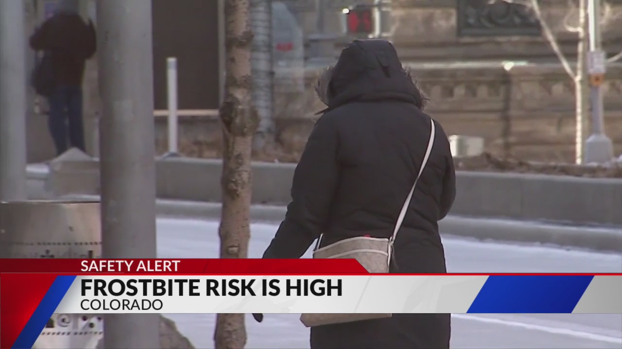 Avoiding frostbite during arctic cold blast – FOX21 News Colorado