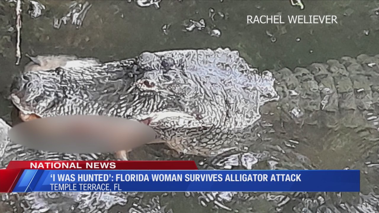 ‘I was hunted’: Florida woman survives alligator attack – WFXRtv