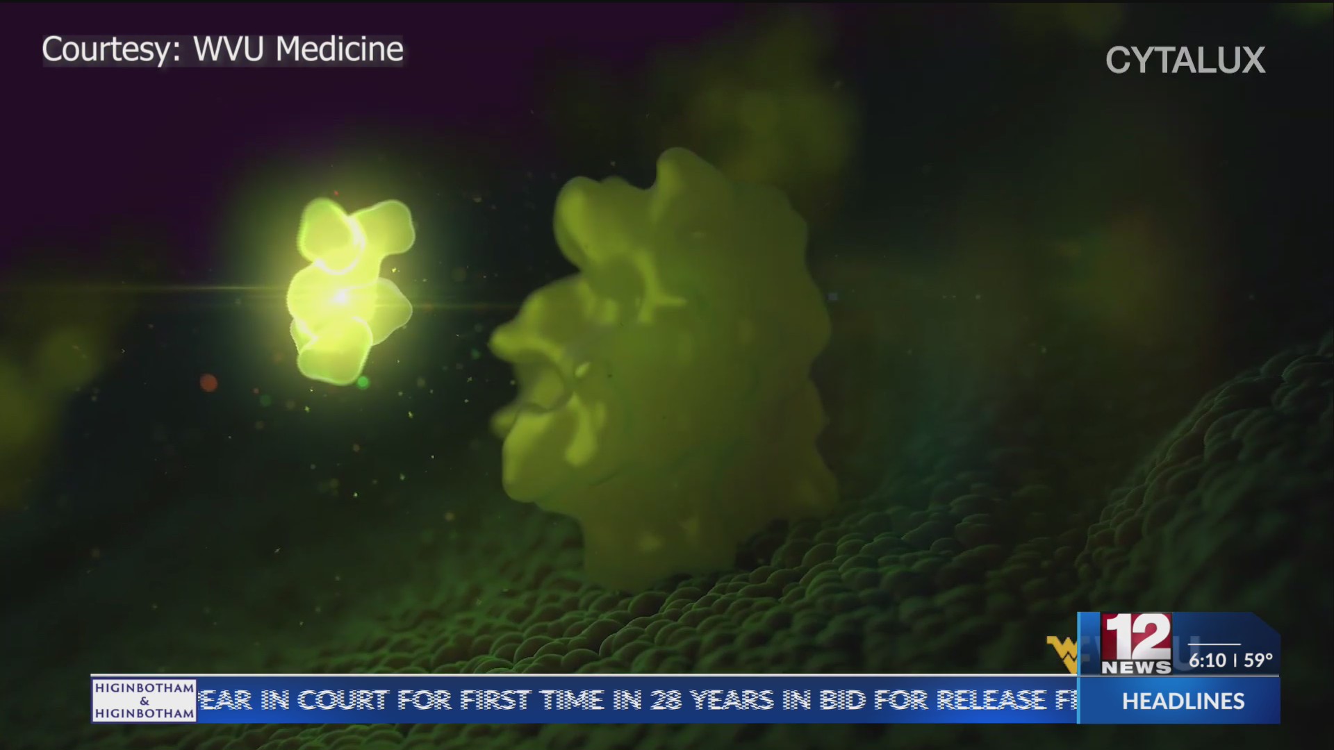UHC becomes first West Virginia hospital to use new technology to ...
