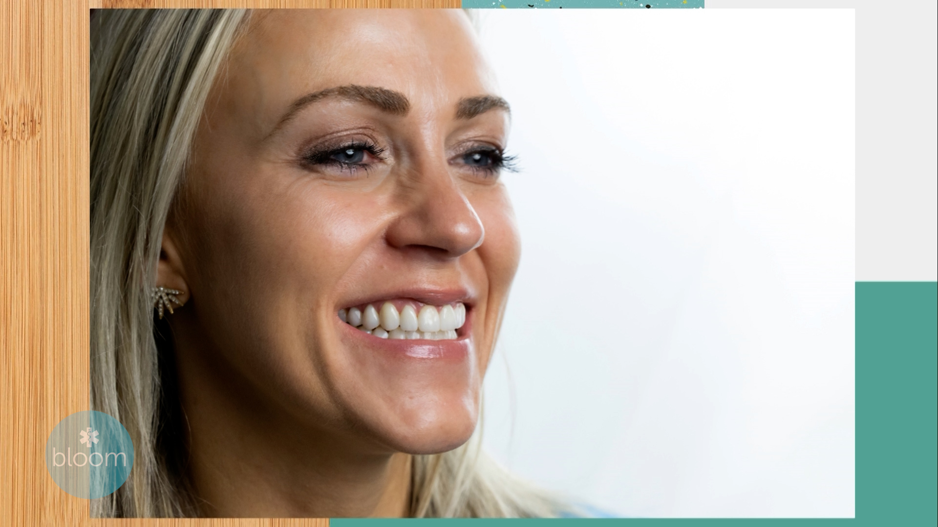 What you need to know about oral makeovers | Bloom – WFLA
