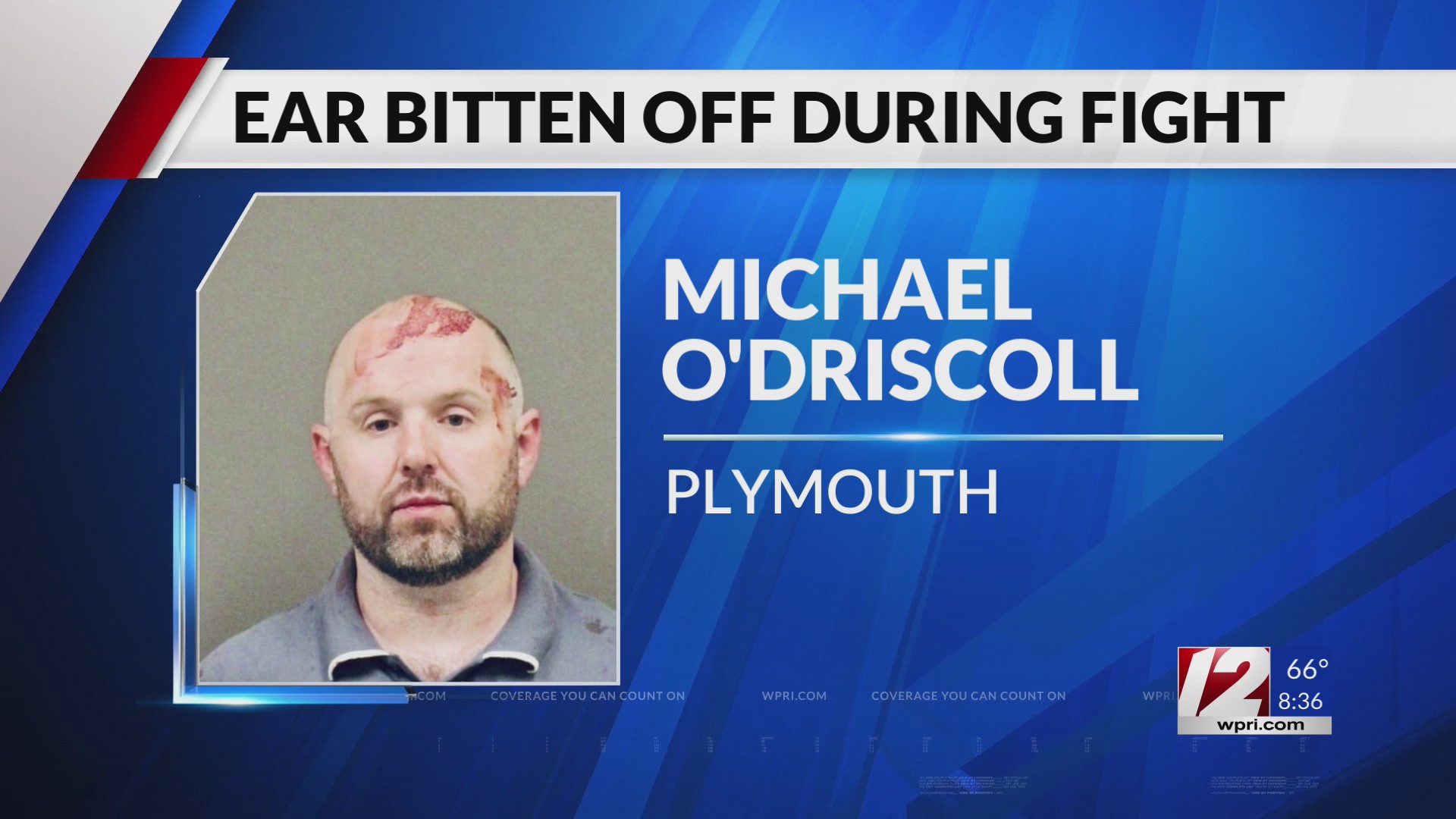 Police: Man’s ear bitten off during fight in Plymouth – WWLP