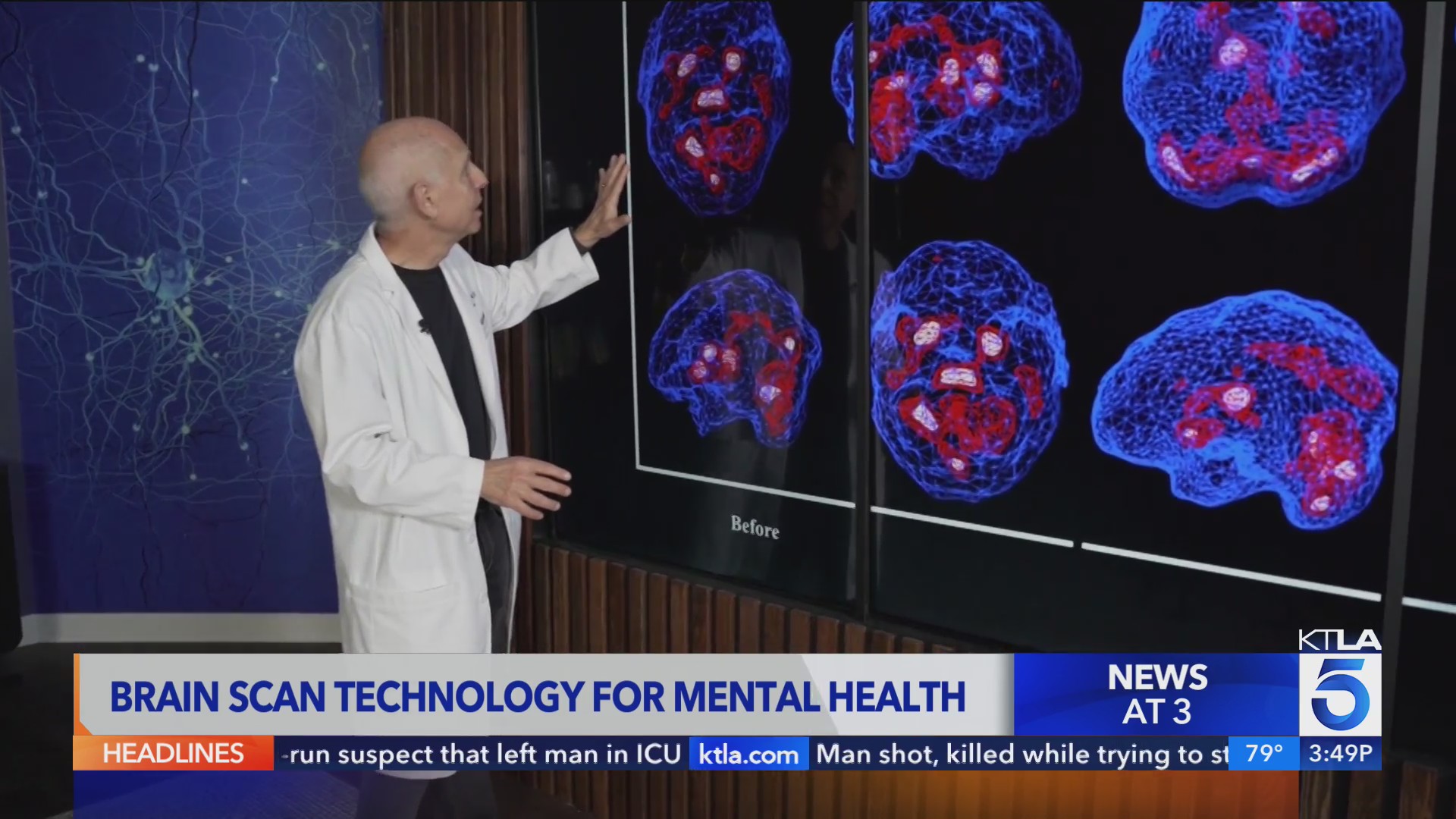 Brain scan technology helps address mental health issues firefighters ...