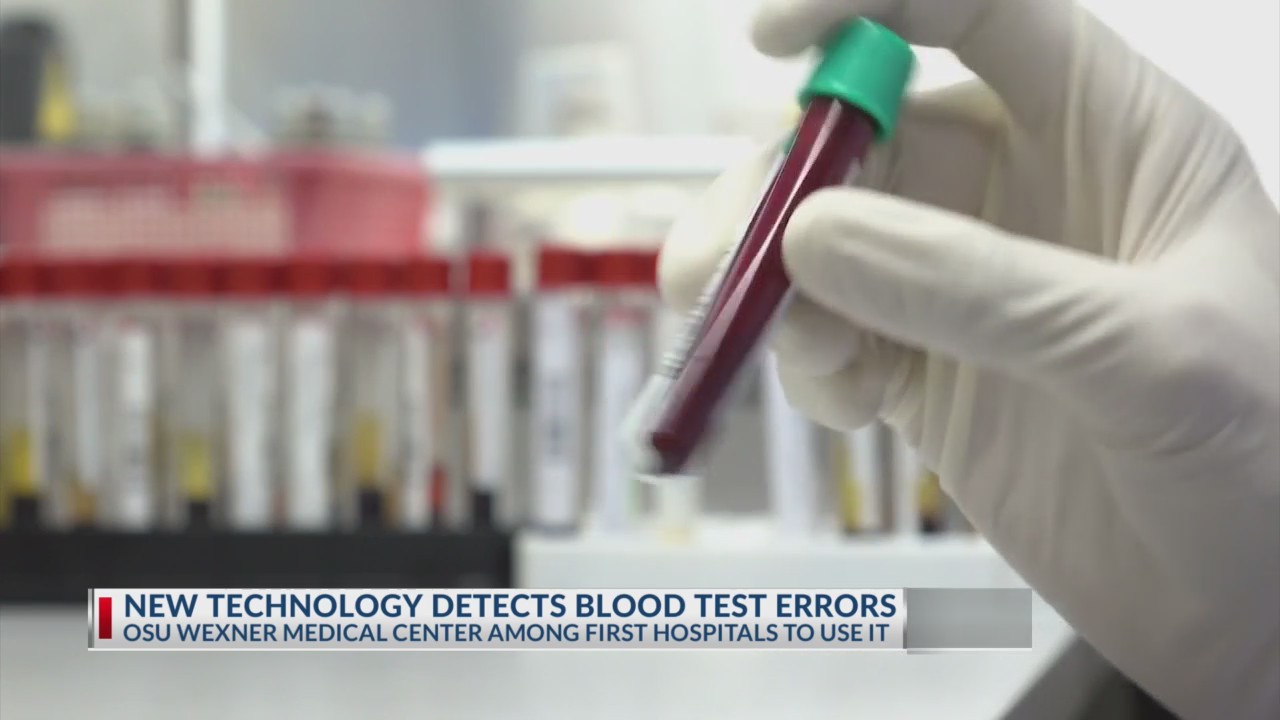 New Ohio State tech detects blood test errors – NBC4 WCMH-TV