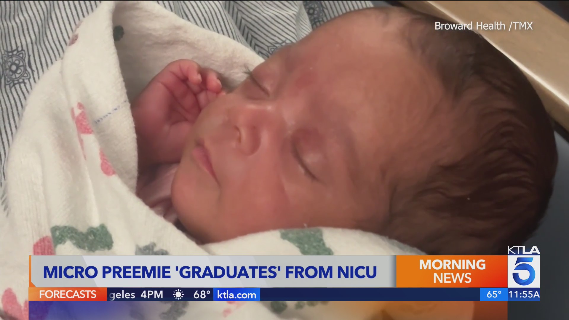 Micro-preemie baby finally ‘graduates’ from NICU – KTLA