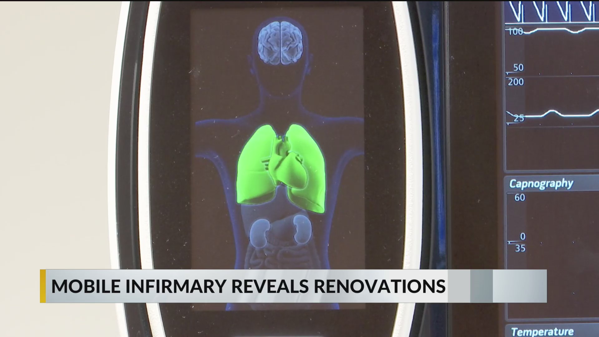 Mobile Infirmary re-opens after new renovations in main hospital – WKRG ...