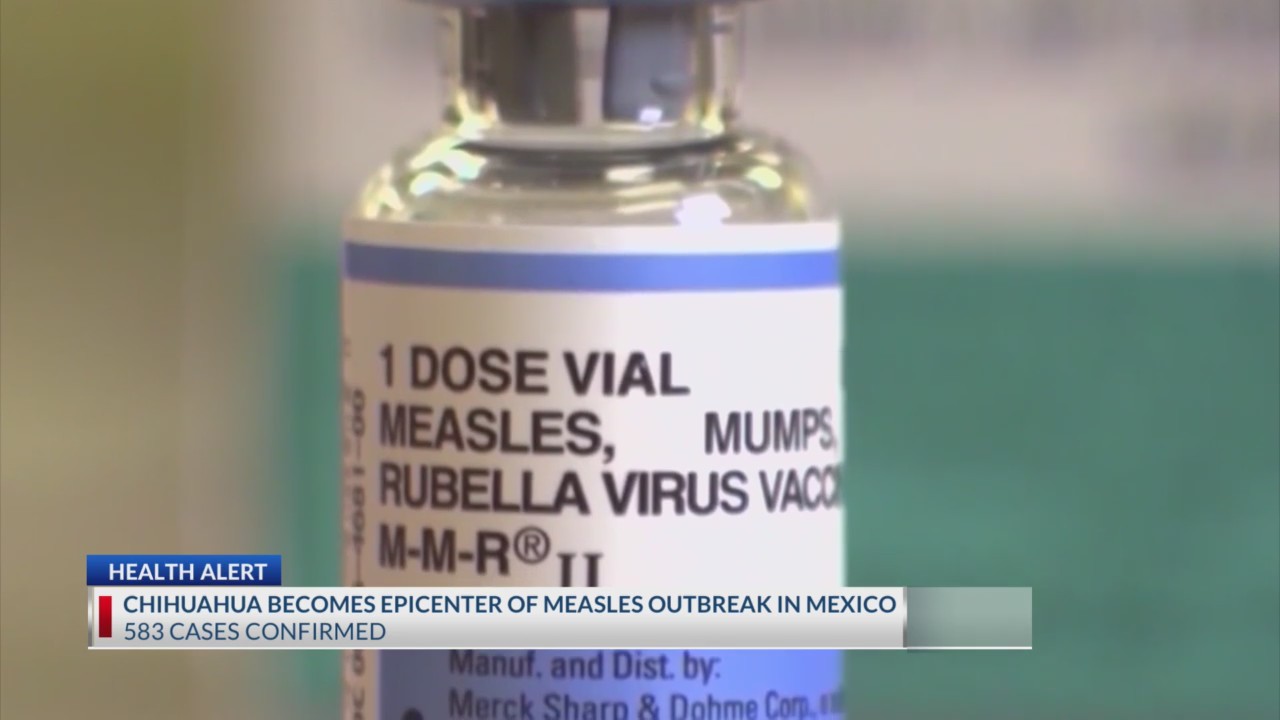 Chihuahua becomes epicenter of measles outbreak in Mexico – KTSM 9 News
