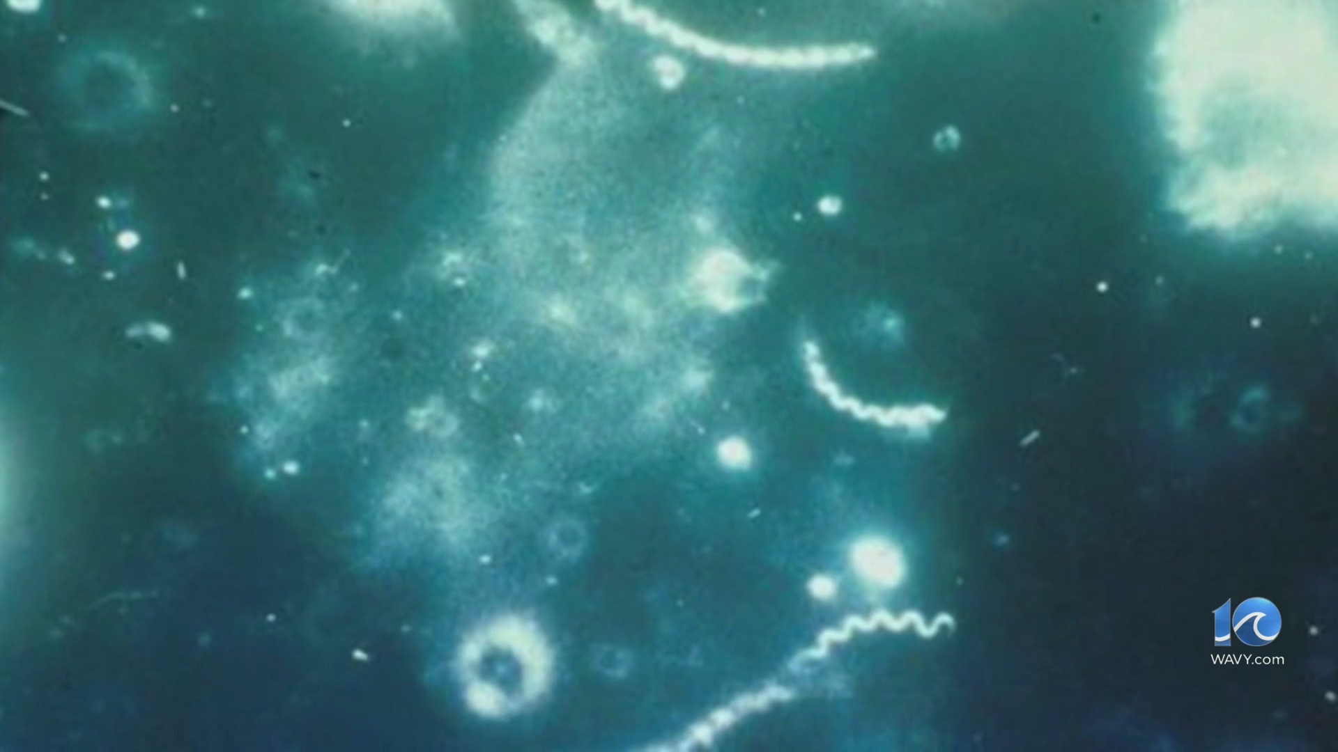 ‘Stop Syphilis’ campaign kicks off in Norfolk – WAVY.com