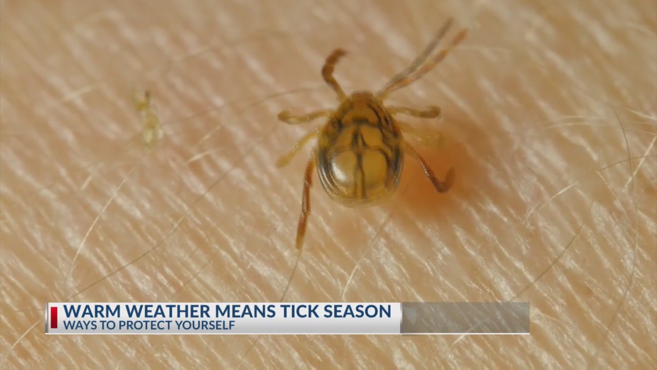 Warm weather means tick season in central Ohio – NBC4 WCMH-TV