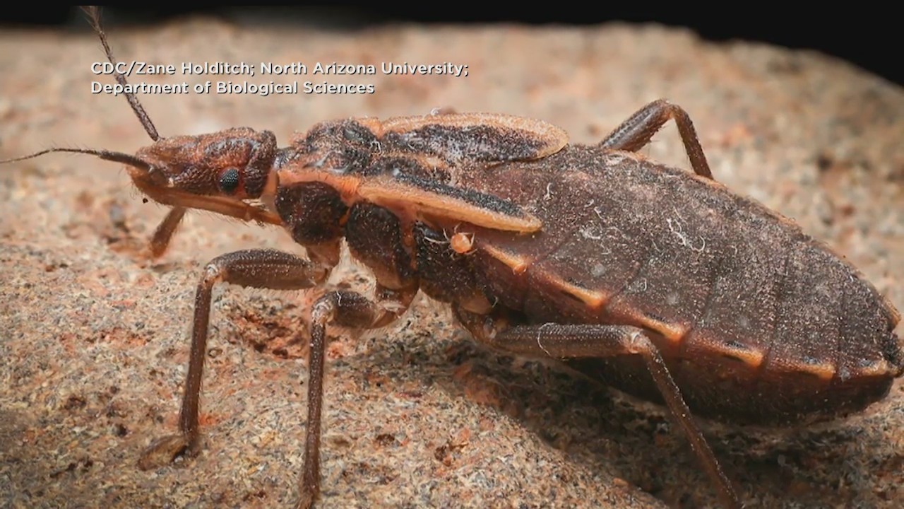 ‘Kissing Bug’: An insect bite you won’t even notice could have deadly ...