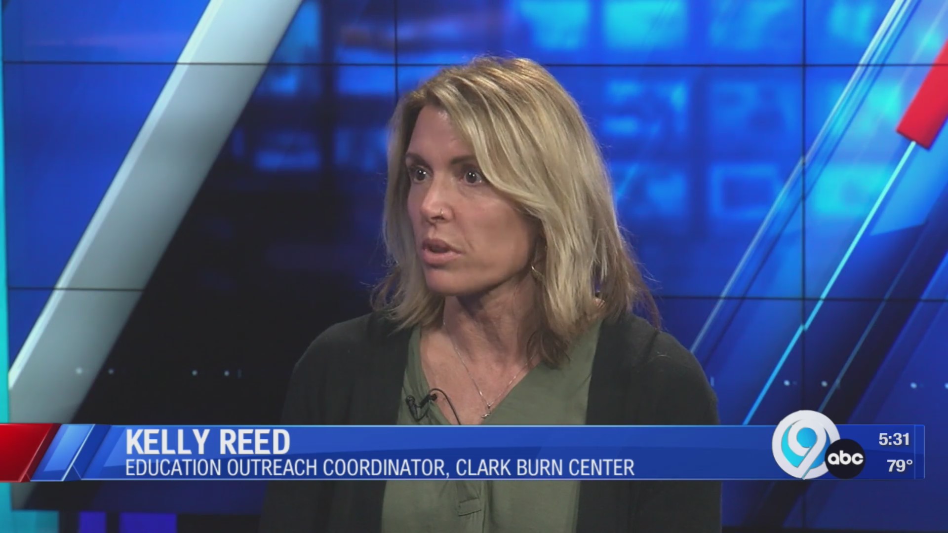 Interview: Kelly Reed talks burn dangers of Chromebook challenge – WSYR