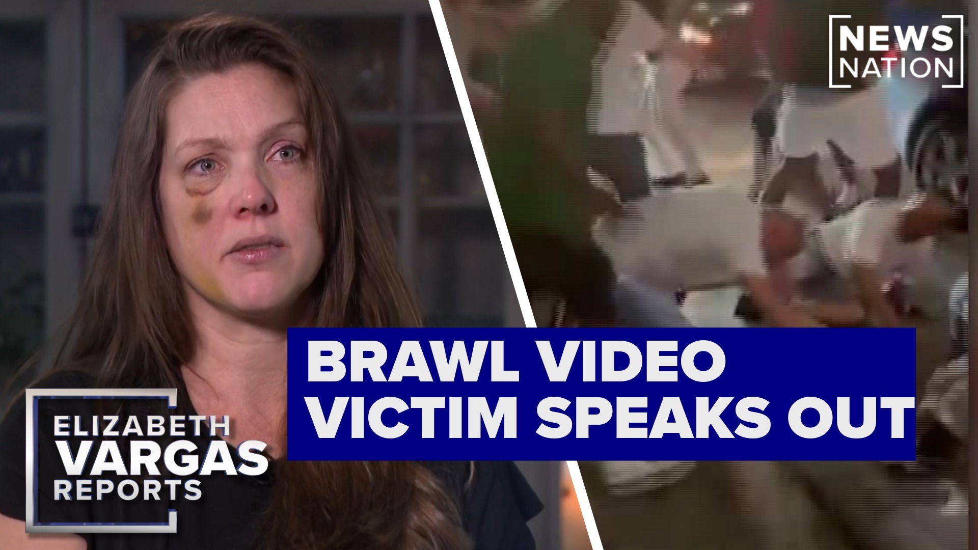 Cincinnati brawl victim not going to be OK ‘for a really long time ...