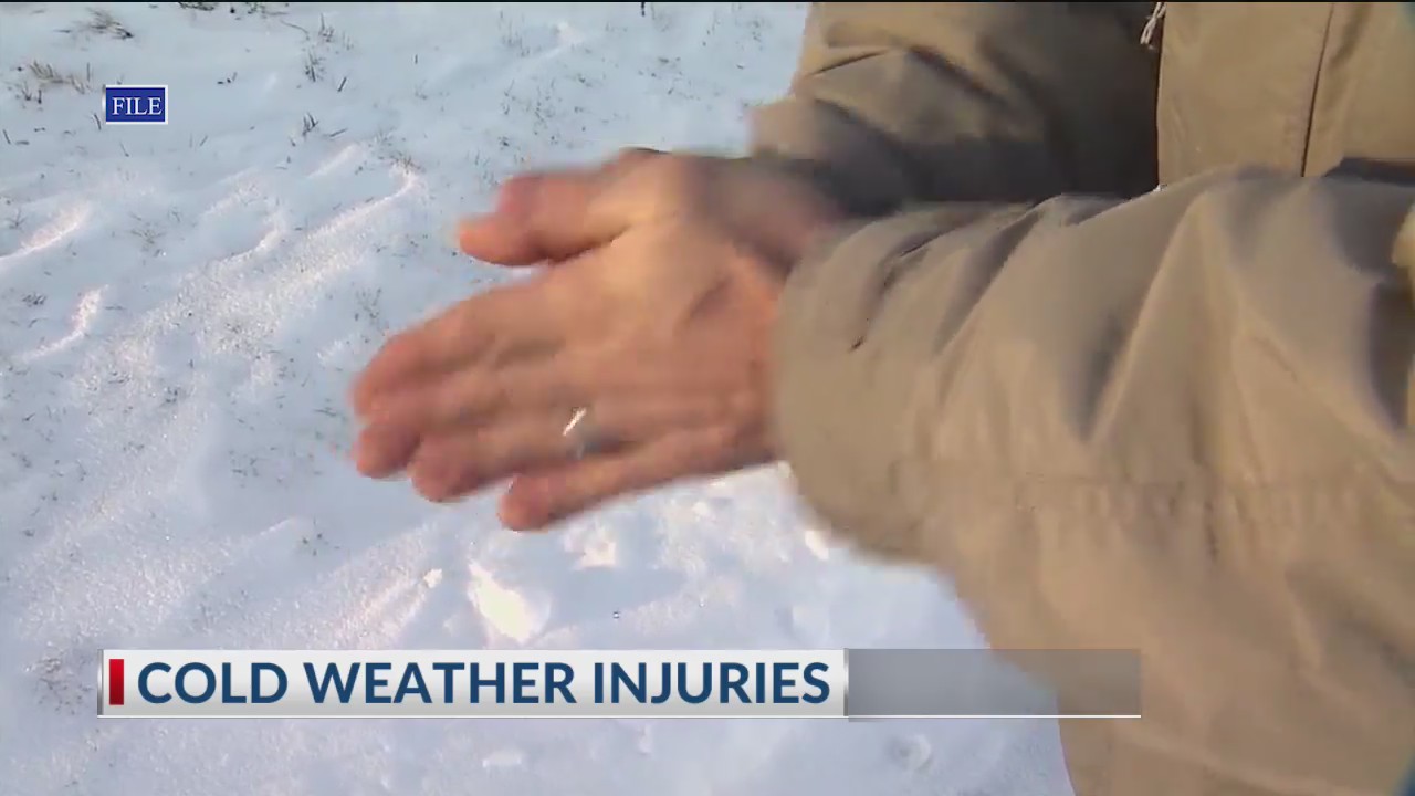 Dozens sent to ER for cold weather injuries – KSNT 27 News