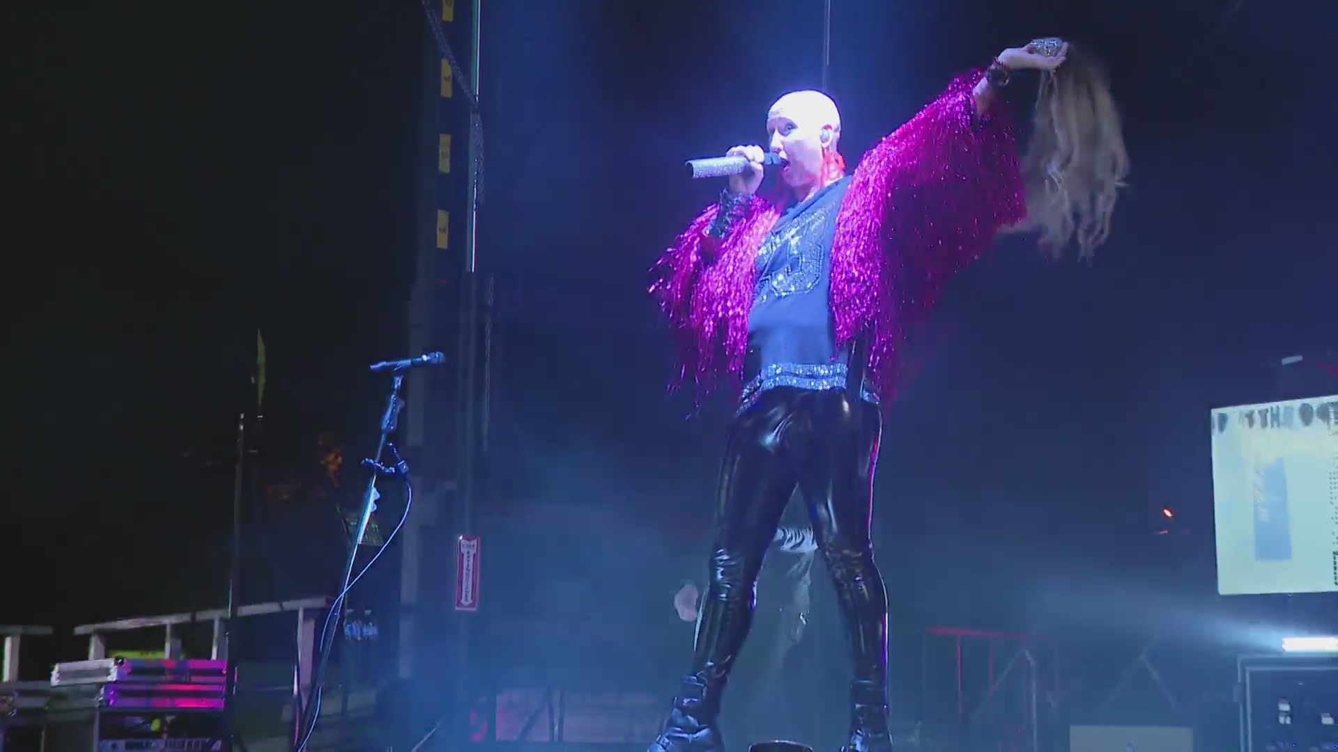 Chicago band’s lead singer embraces alopecia with powerful message – WGN-TV