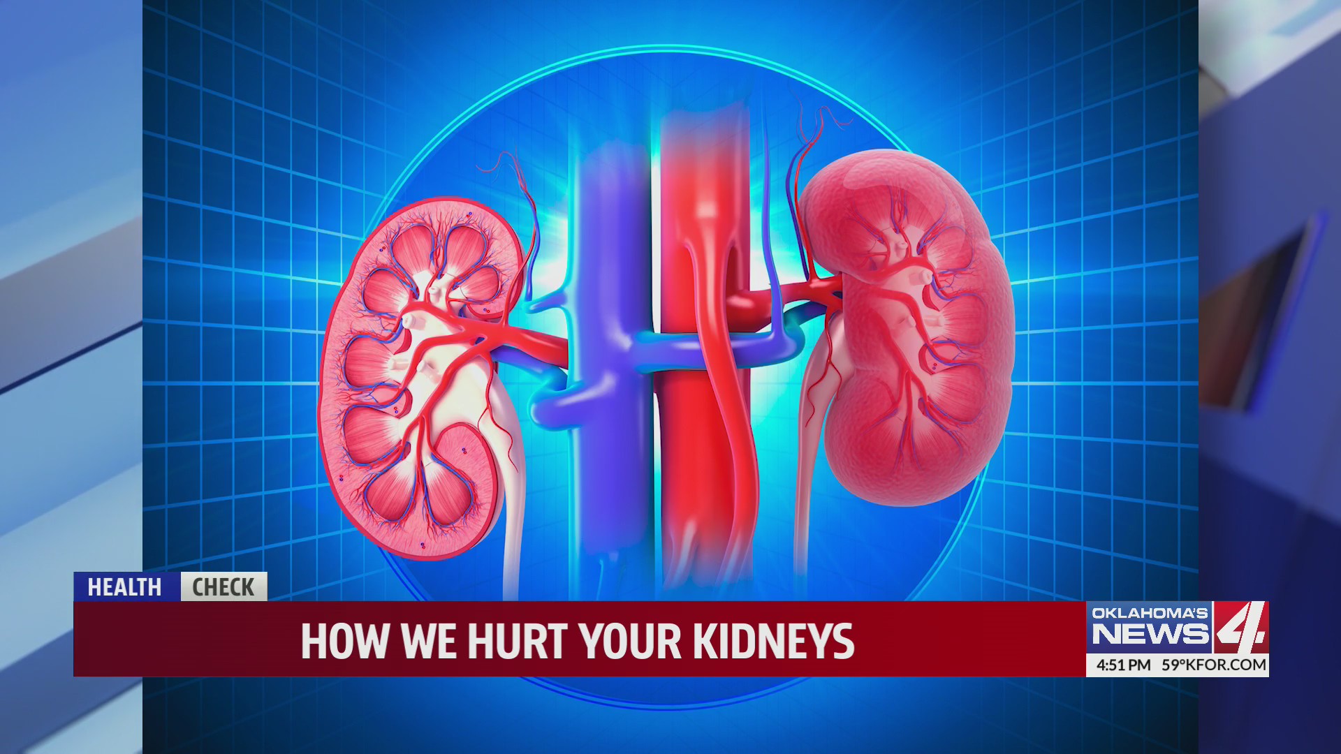 How we hurt our kidneys – KFOR.com Oklahoma City