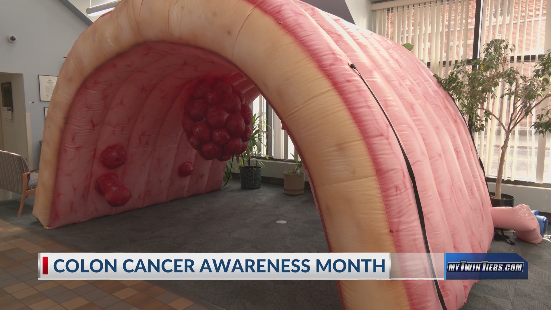 What are the red flags of colon cancer? Arnot Health doctor explains ...