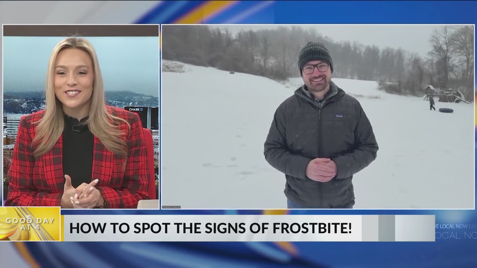 Expert explains how to spot the signs of frostbite – WOWK 13 News