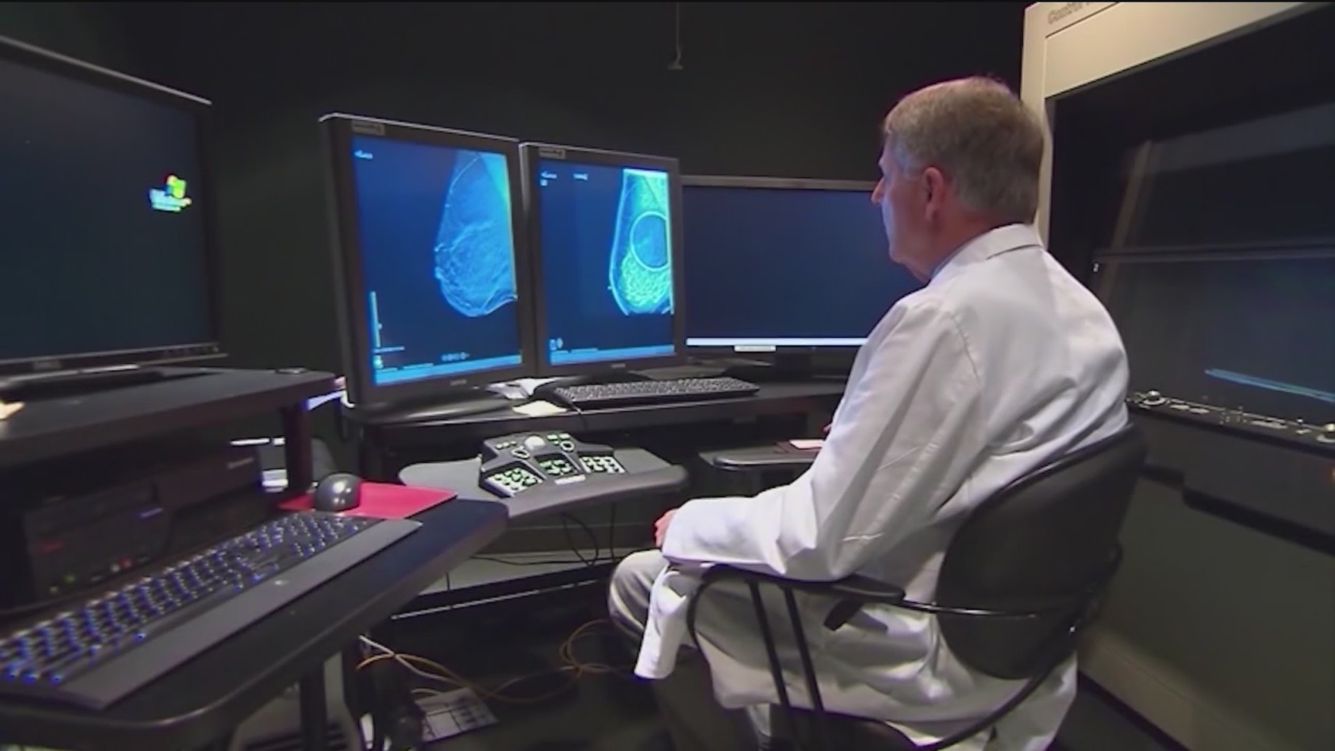 Mammogram results have changed. Here’s how – WTNH.com