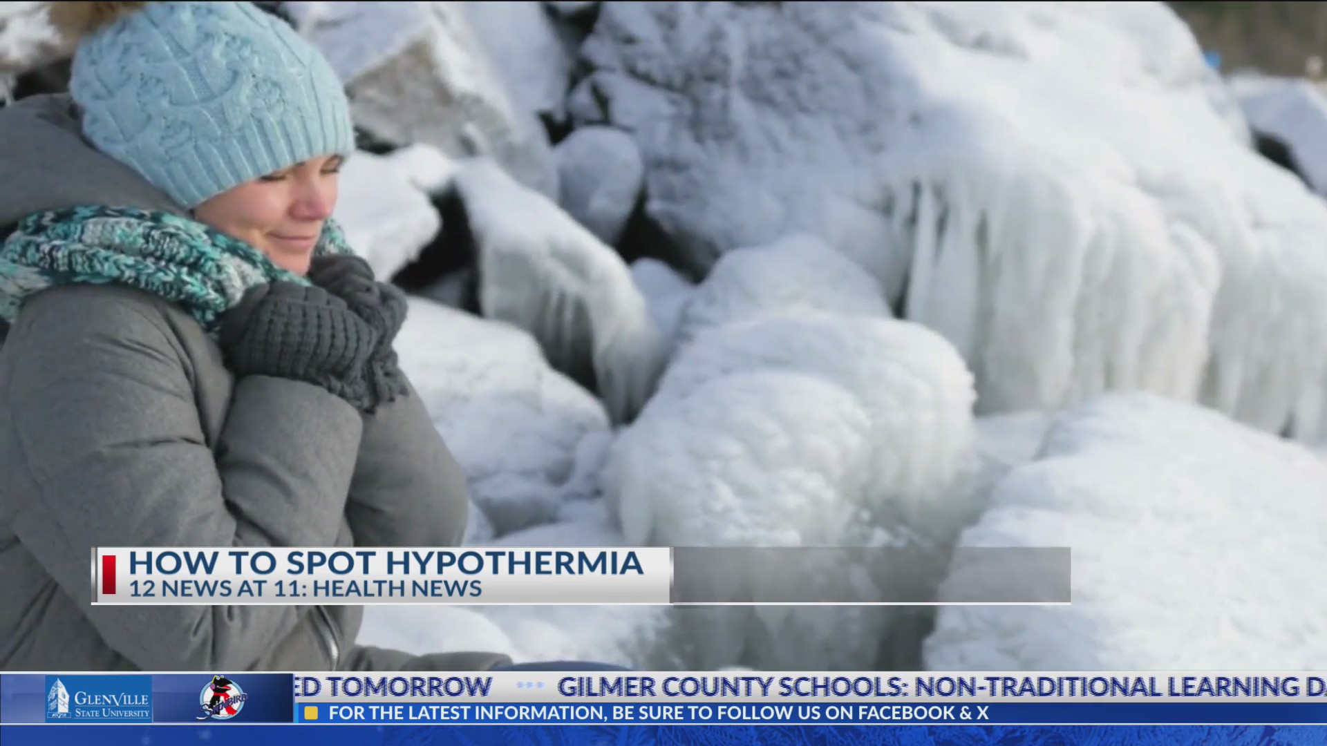How to spot symptoms of hypothermia – WBOY.com