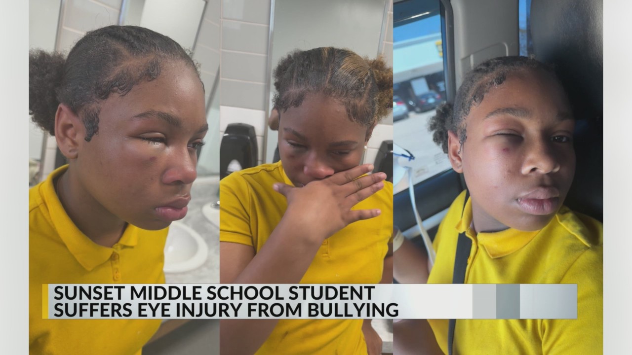 Mother speaks out on bullying after daughter suffers eye injury at ...