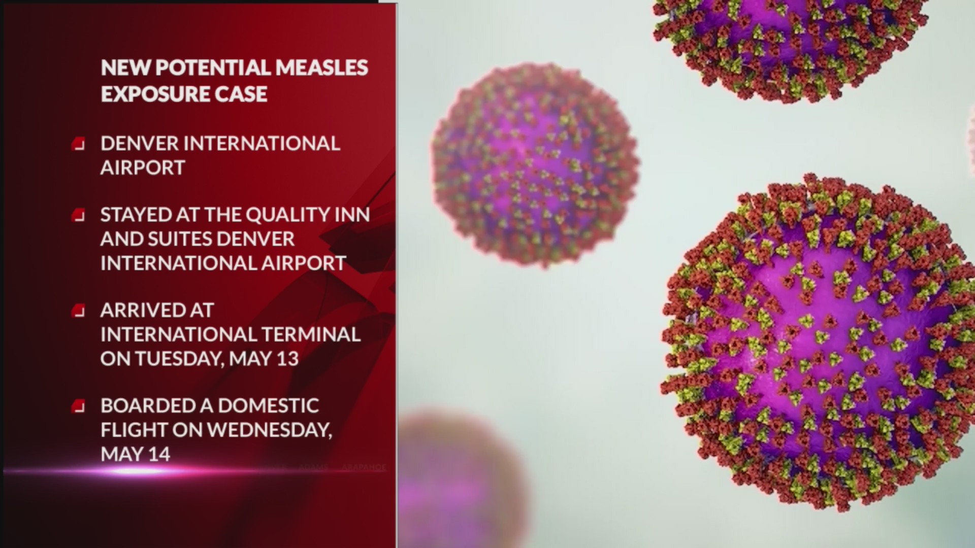 Health officials warn of measles exposure at DIA – FOX31 Denver