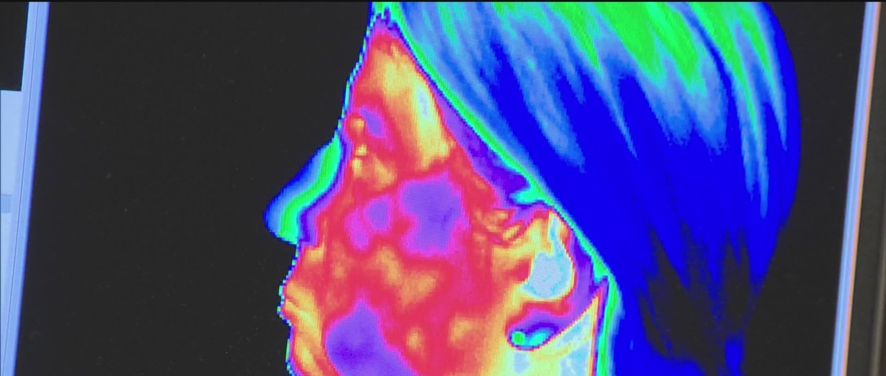 New York doctor adopts thermography as alternative to painful biopsies ...