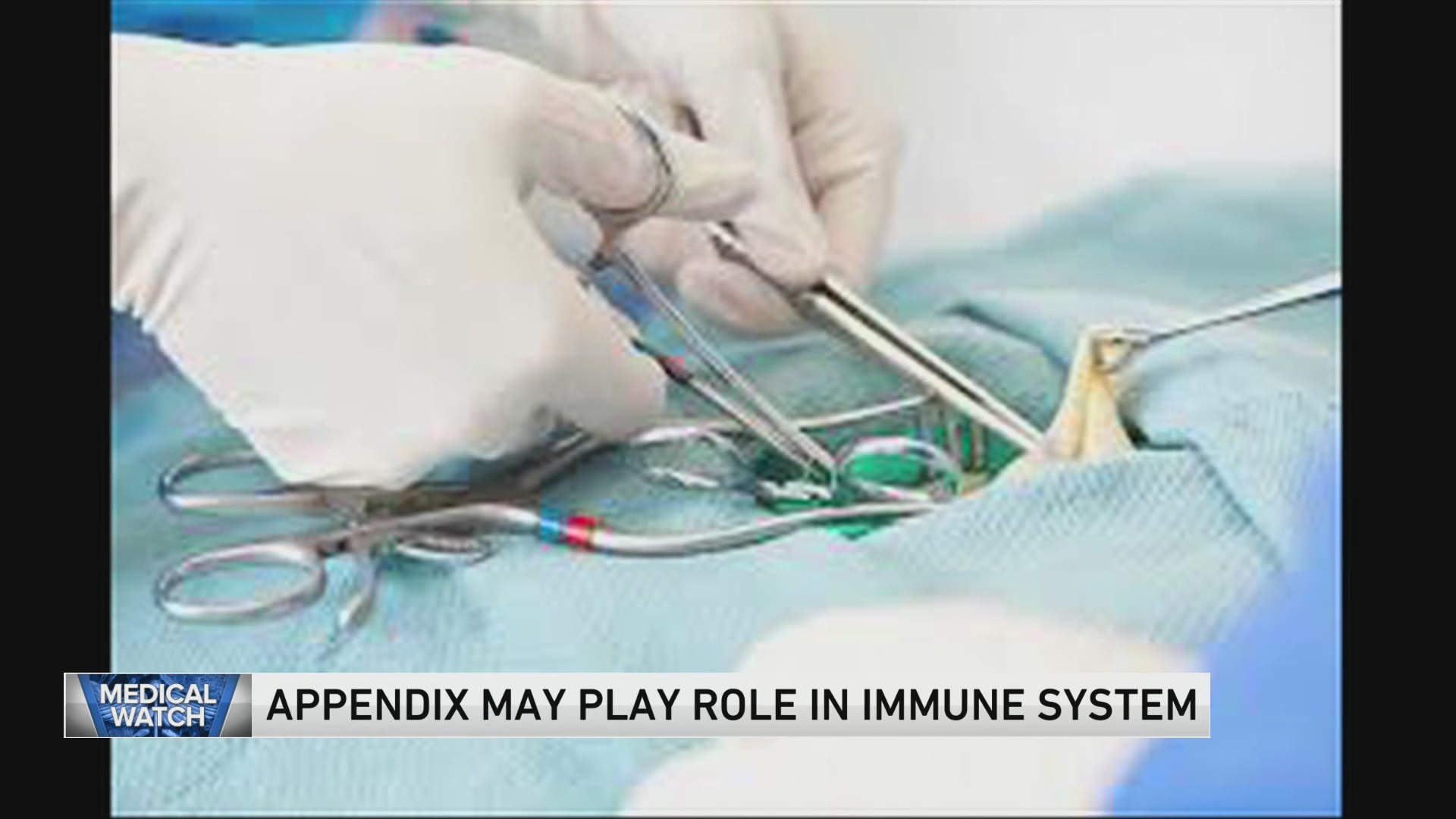 Appendix may play role in immune system — and more – WGN-TV